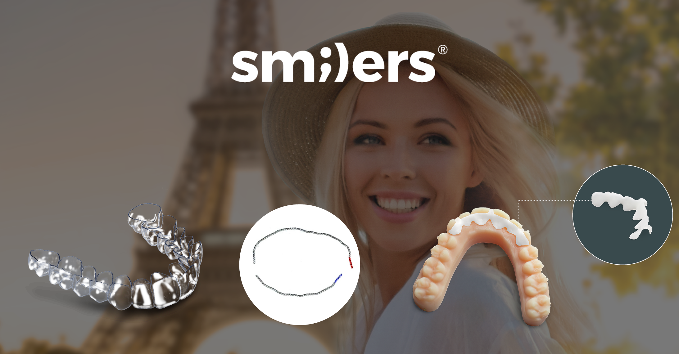 What happens when my Smilers® orthodontic treatment is finished? - Smilers