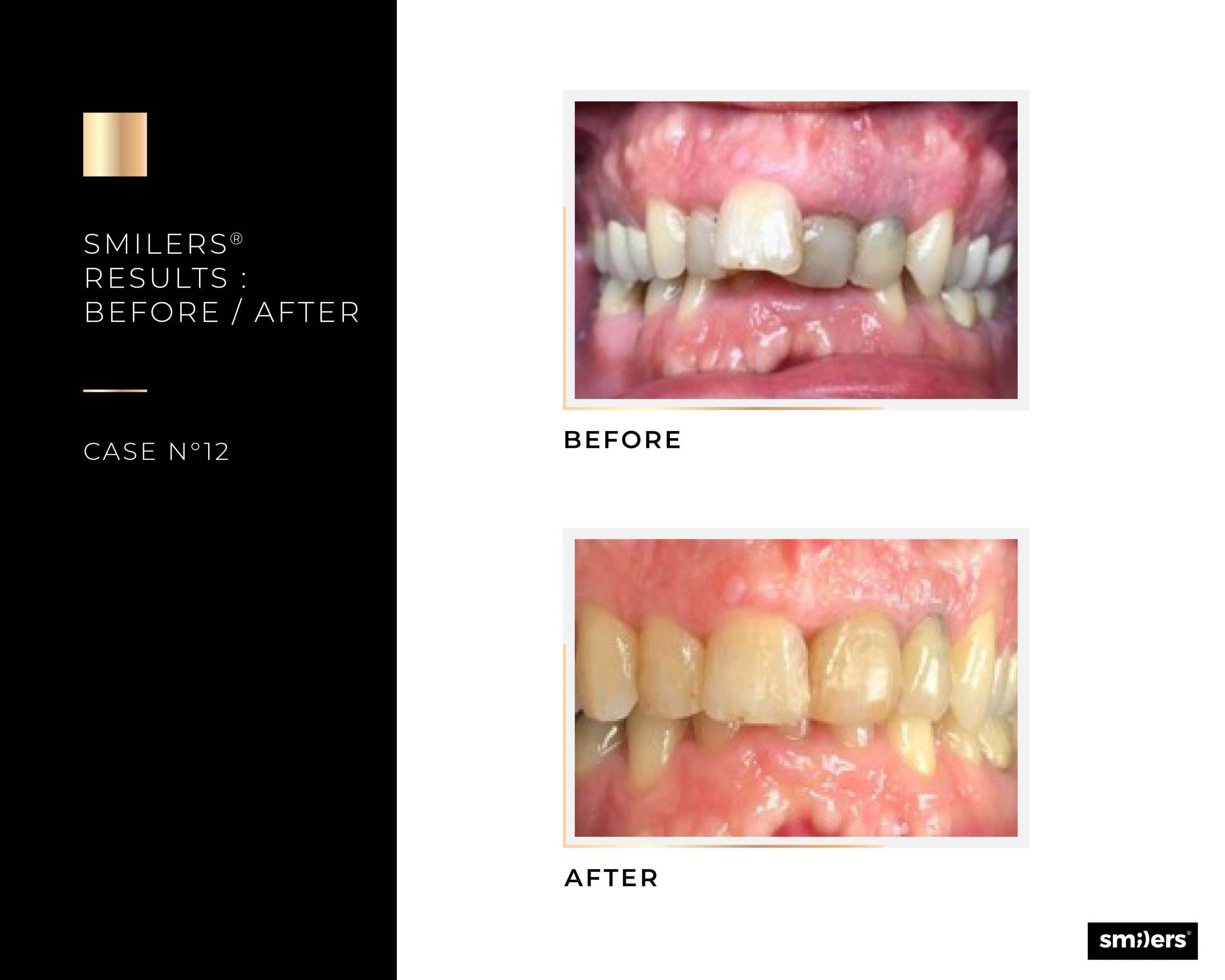 SimpLy Galleries - Smilers