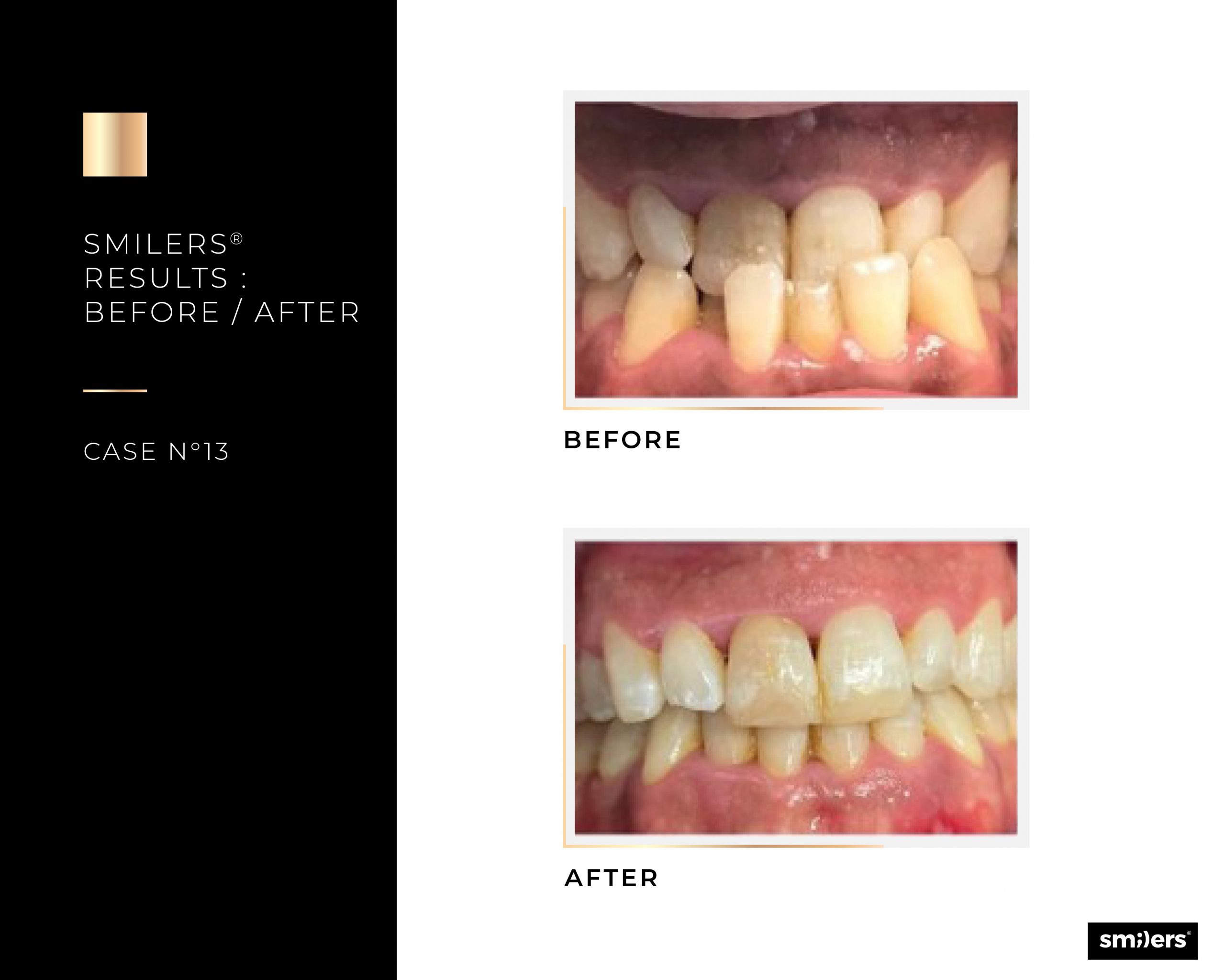 SimpLy Galleries - Smilers