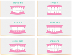 Results and treatable cases - Smilers