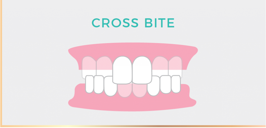 Resultados e casos tratáveis - Smilers
